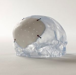 Biomedical applications of polyethylene - Biofabrication and Tissue ...