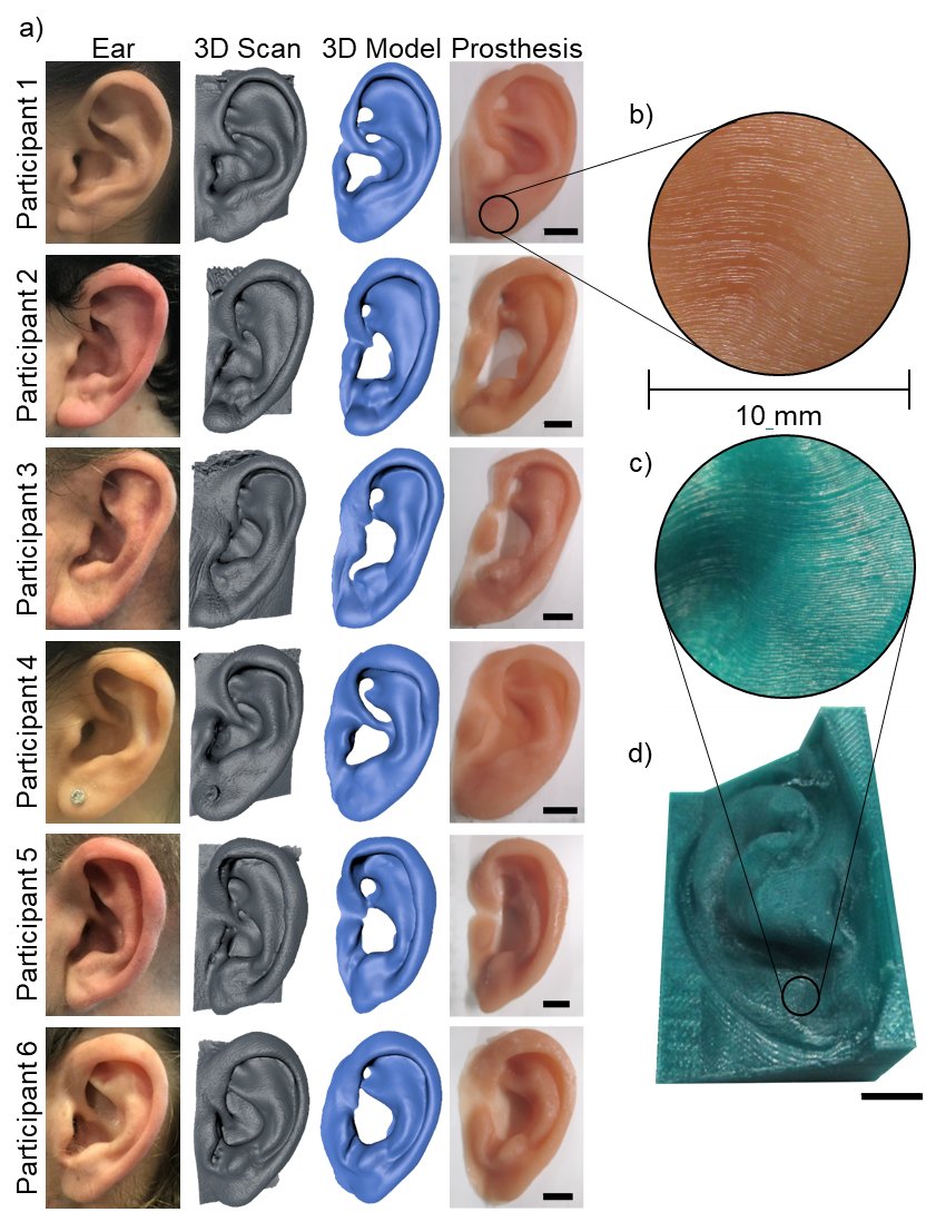 An advanced prosthetic manufacturing framework for economic ...