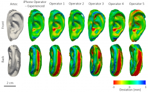 A protocol for clinically accessible 3D ear scanning using smartphones ...