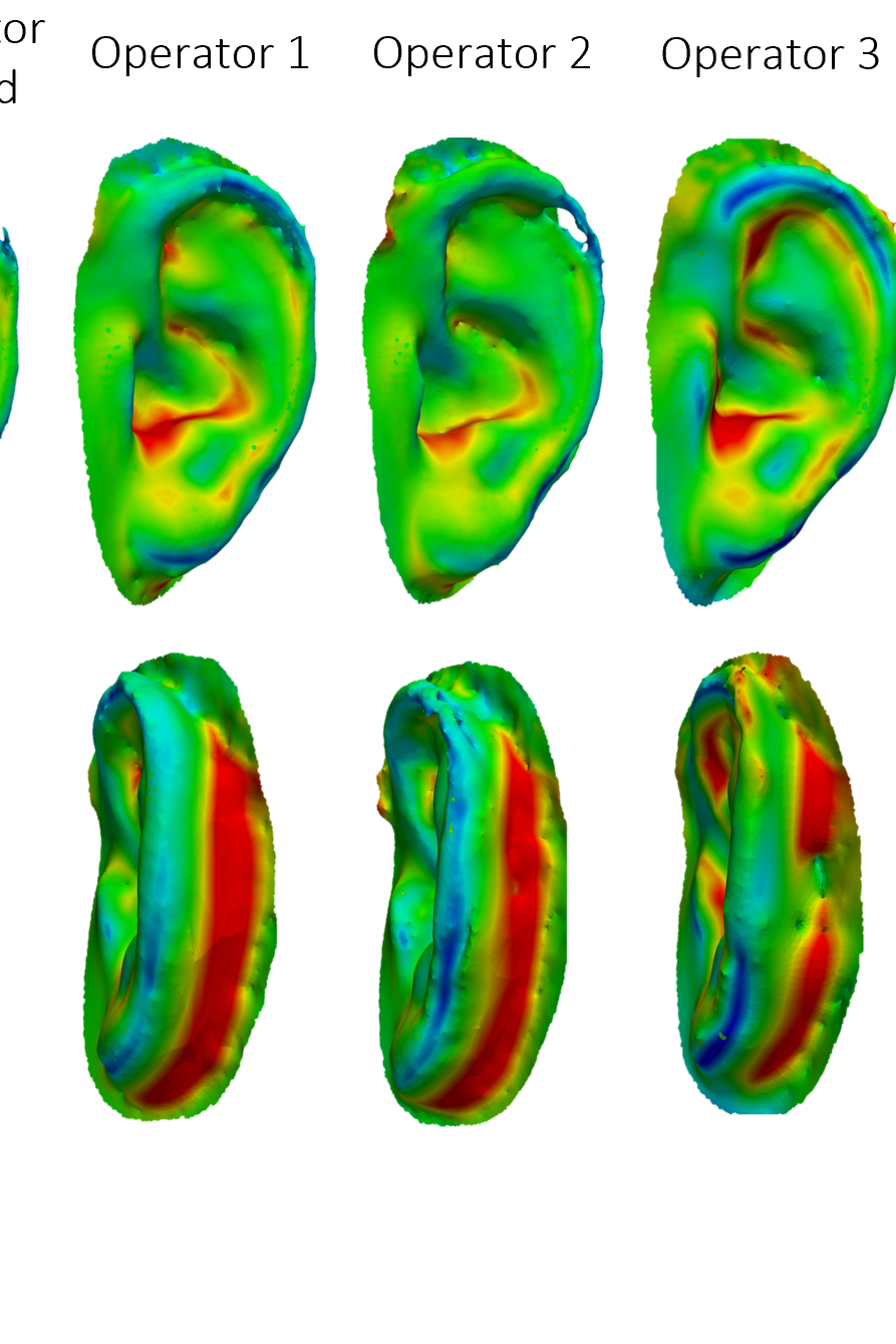 A protocol for clinically accessible 3D ear scanning using smartphones ...