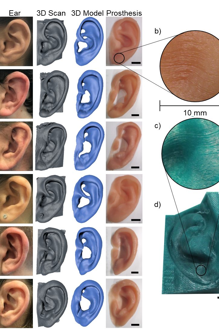 An advanced prosthetic manufacturing framework for economic ...