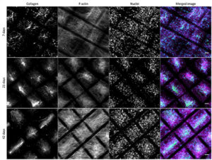 Melt electro-written scaffolds with box-architecture support ...
