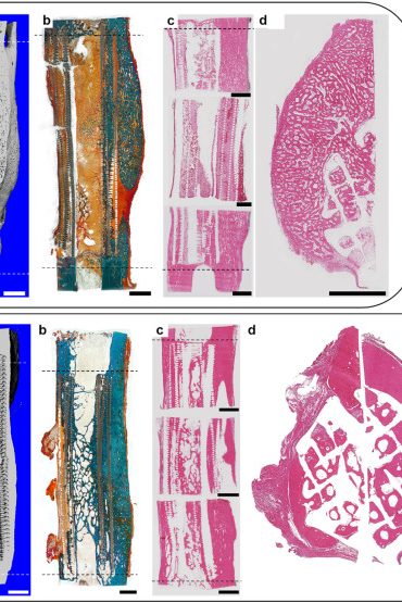 Scaffold Guided Bone Regeneration In Large Volume Tibial Segmental Defects Biofabrication And