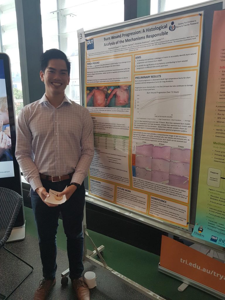 HDR Student Symposium - Burns and Trauma Research