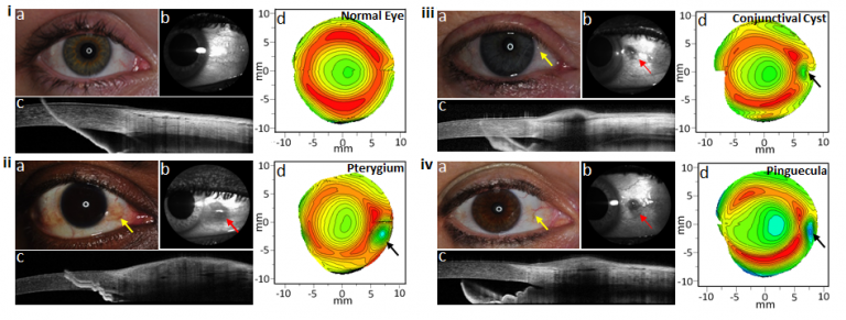 Imaging of the Eye - Contact Lens and Visual Optics Laboratory