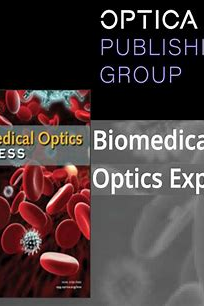 Employing texture loss to denoise OCT images using generative ...