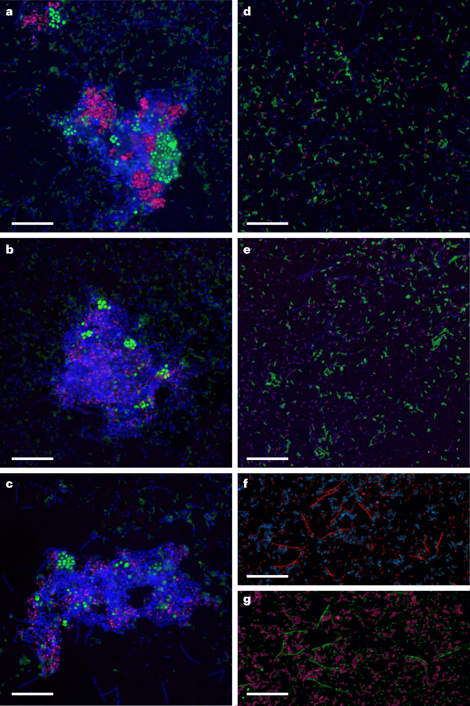 Anaerobic methanotroph ‘Candidatus Methanoperedens nitroreducens’ has a ...