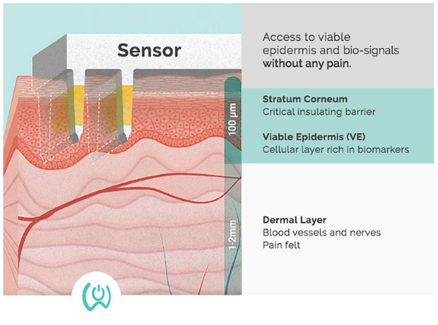 Real-time microwearable sensor for monitoring human hydration status ...