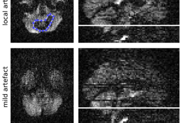 Projects - Medical Physics