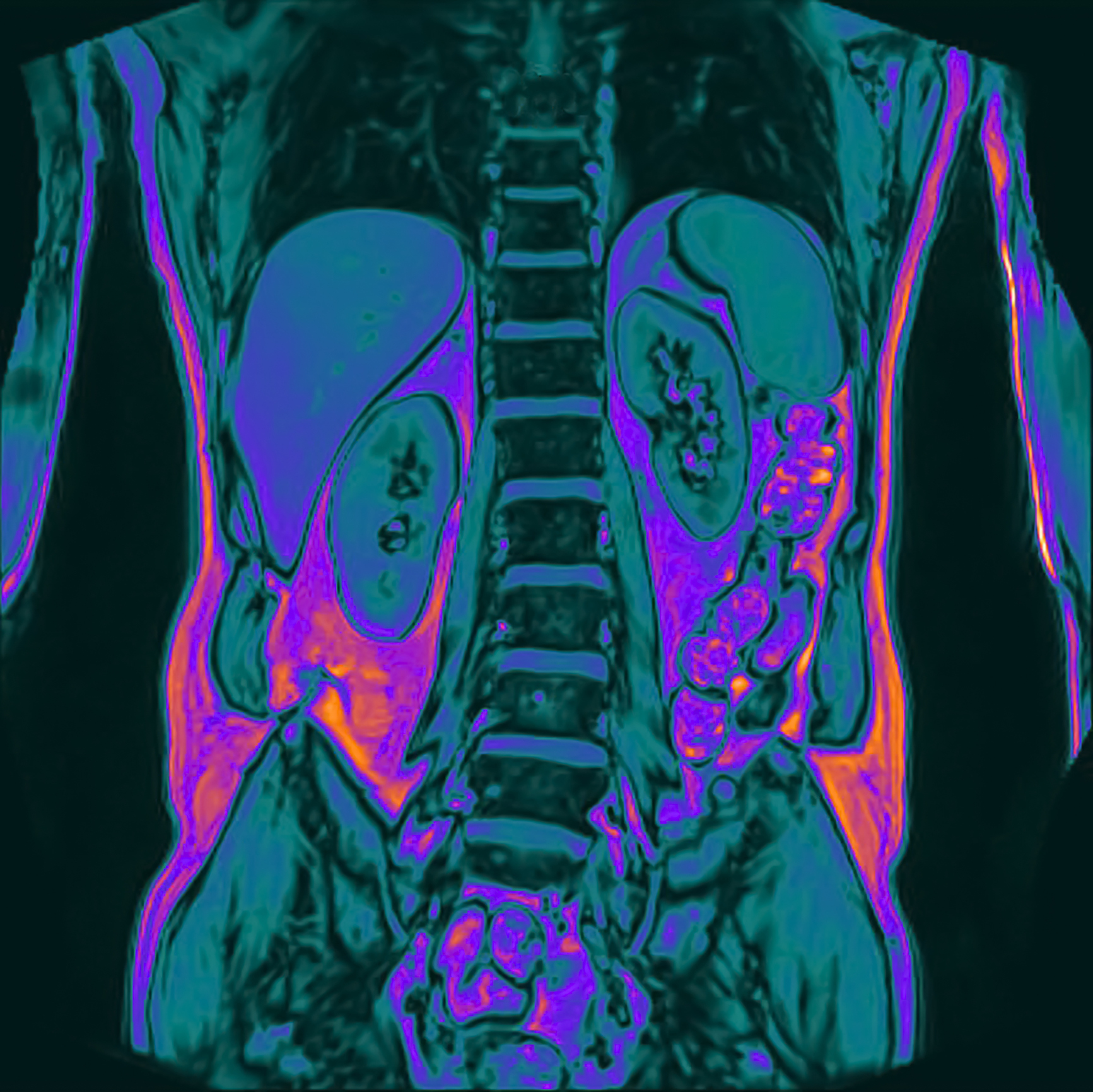 Development of neutral radical-based molecular imaging agents ...