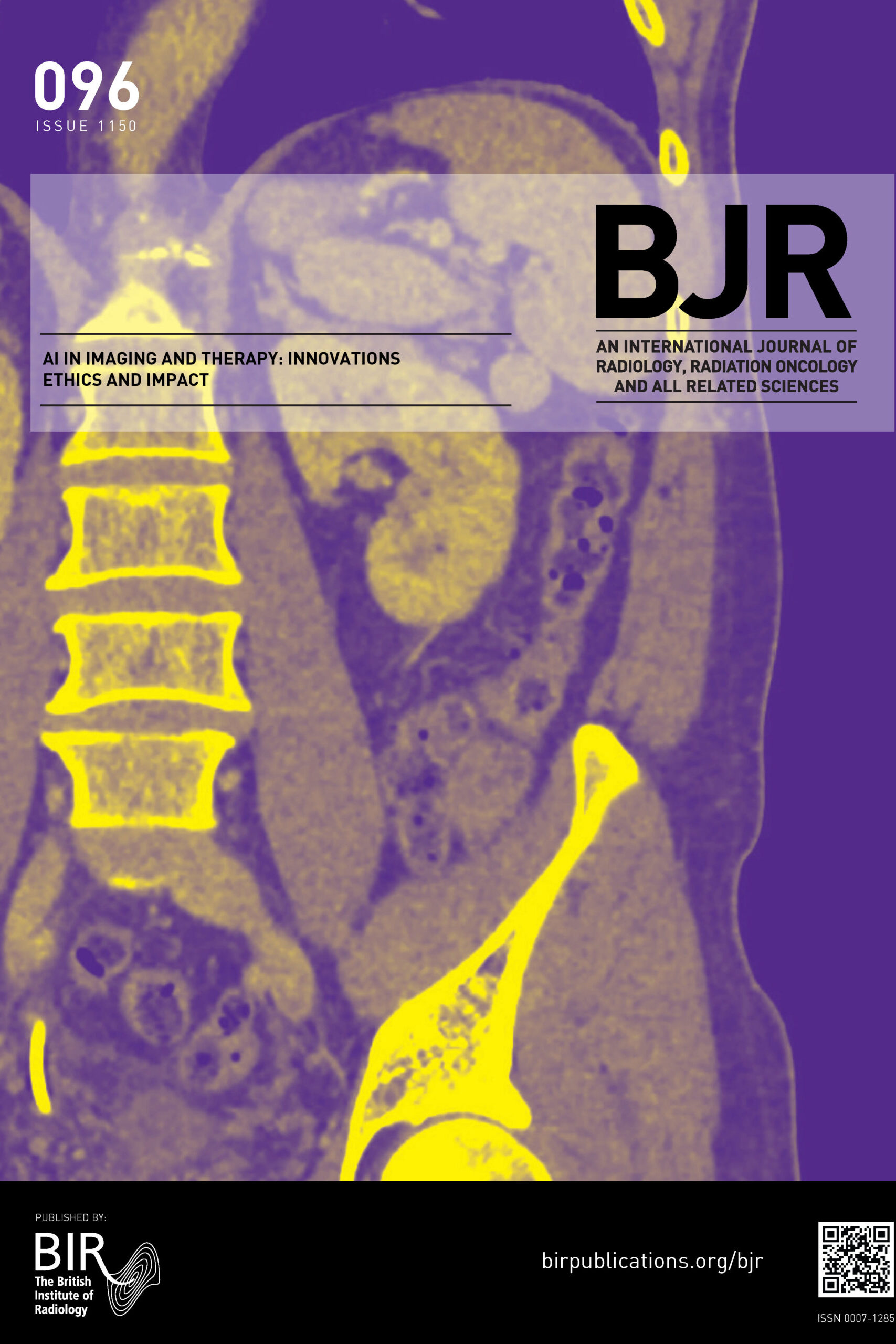 Bi-plane and single plane angiography: a study to compare contrast ...