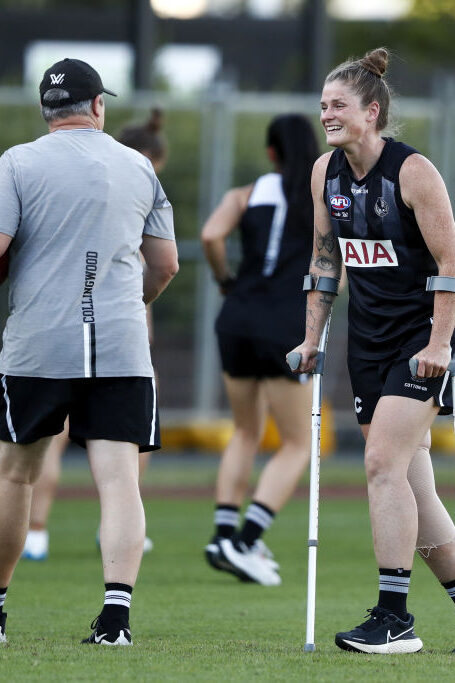 Anterior Cruciate Ligament Reconstruction Increases the Risk of ...