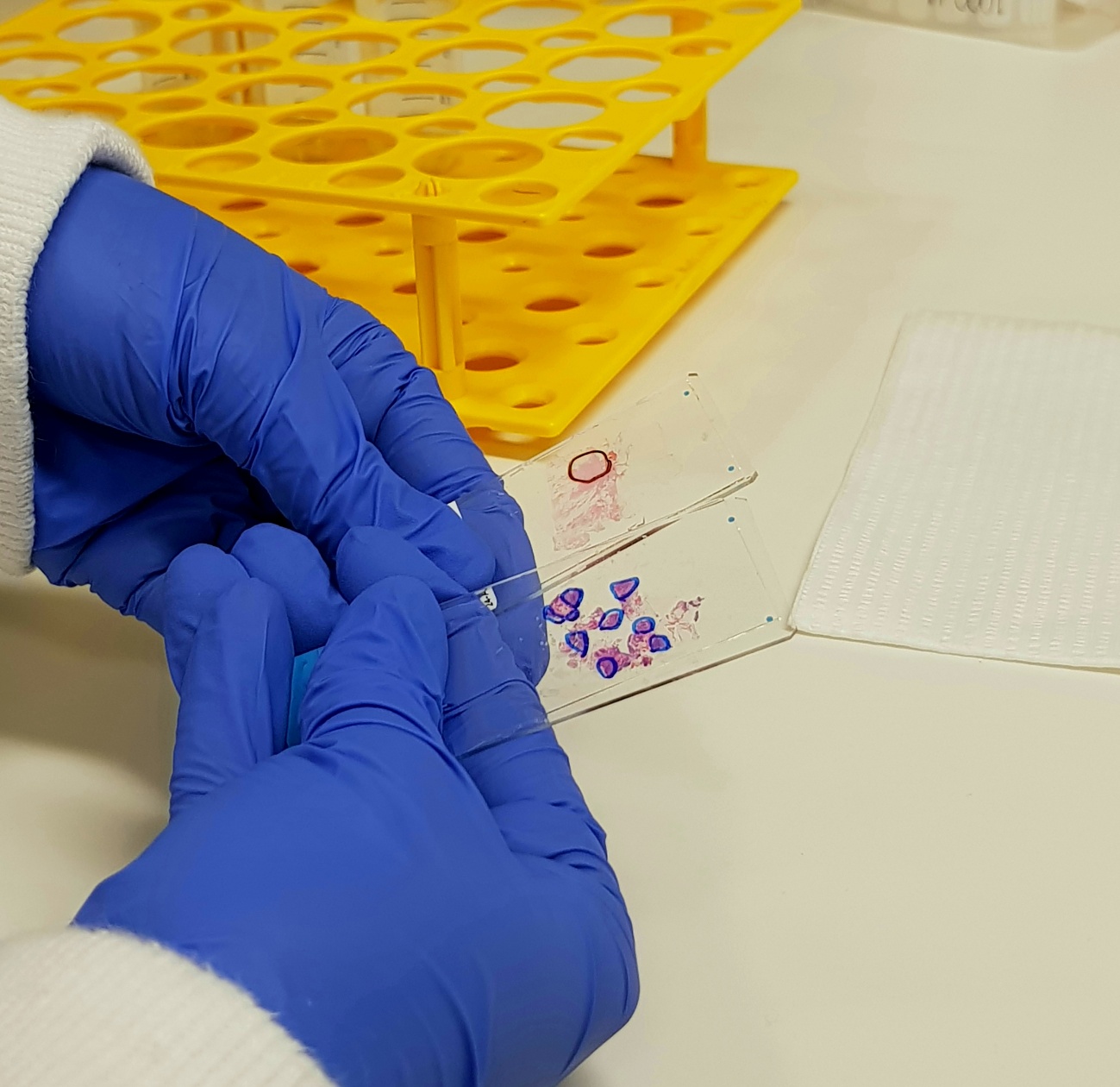 The ATGC are now able to perform whole-exome sequencing on formalin ...